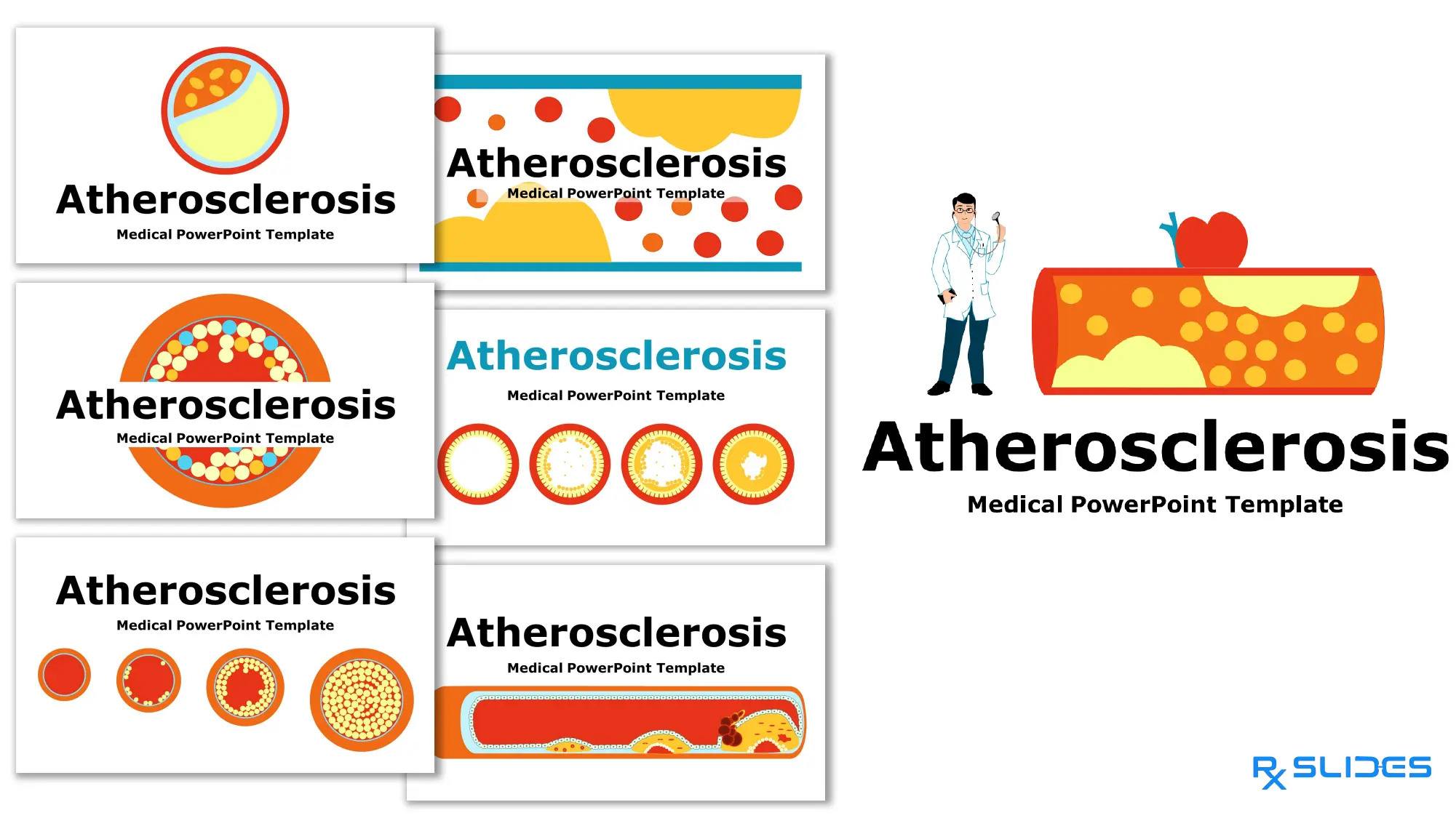 Download Atherosclerosis PowerPoint Template| RxSlides